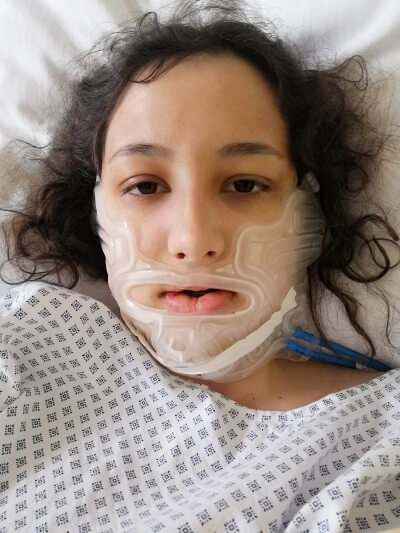 Bimax-Operation Erfahrungsbericht einer Betroffenen