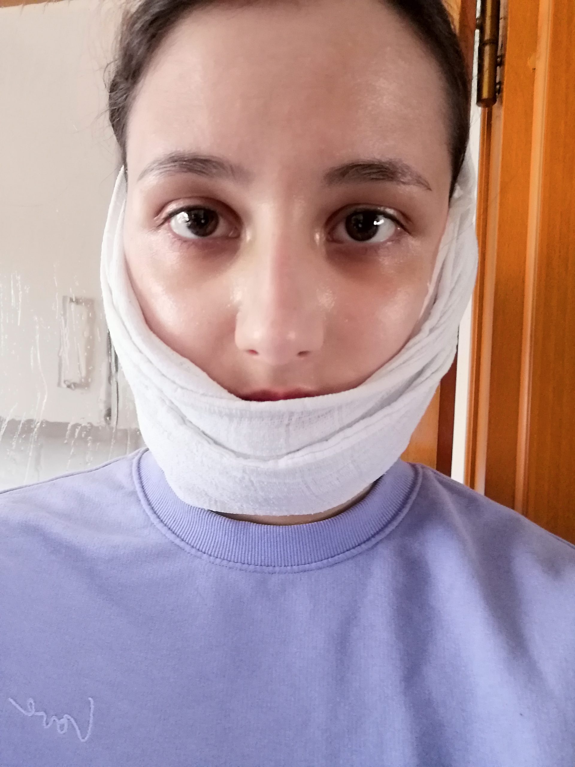 15 Tipps und Empfehlungen für vor und nach einer Bimax-Operation